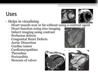 Diagnostic Investigations of Cardiovascular System | PPTX