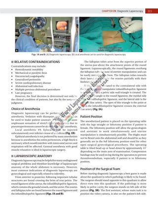 Diagnostic Laparoscopy in Laparoscopic Surgical Procedure.pdf