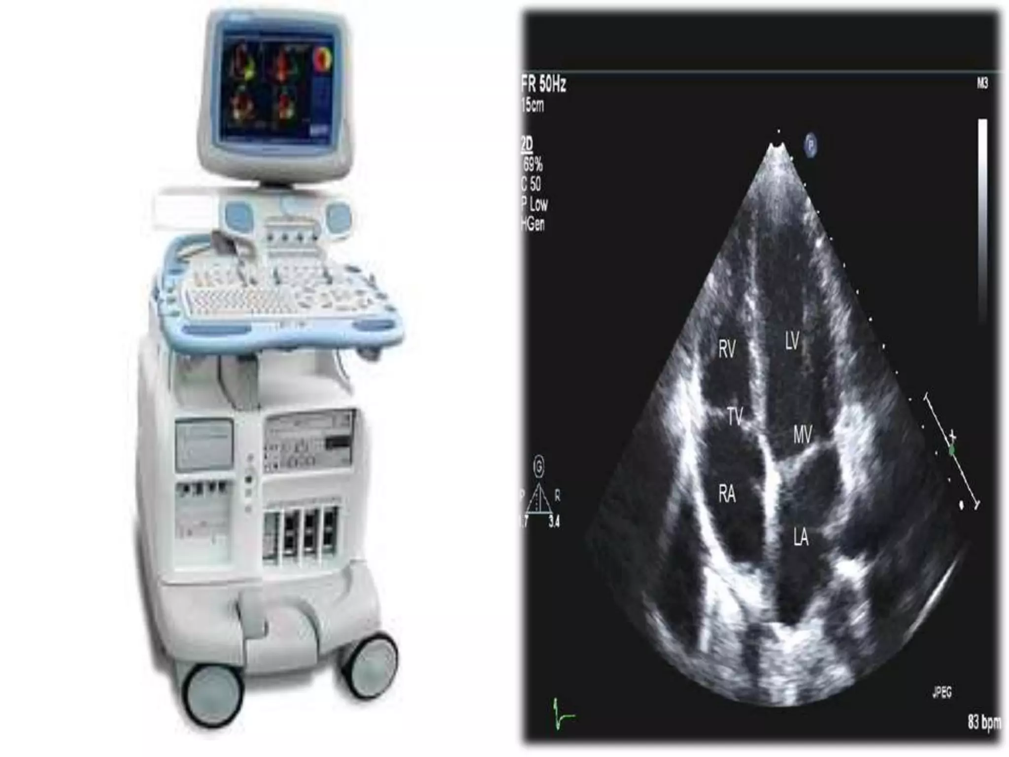 Diagnostic measures in cardiology | PPTX
