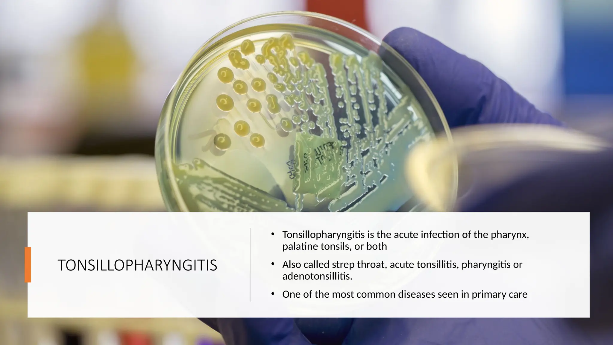 DIAGNOSTIC METHODS FOR TONSILLOPHARYNGITIS - ACUTE.pptx
