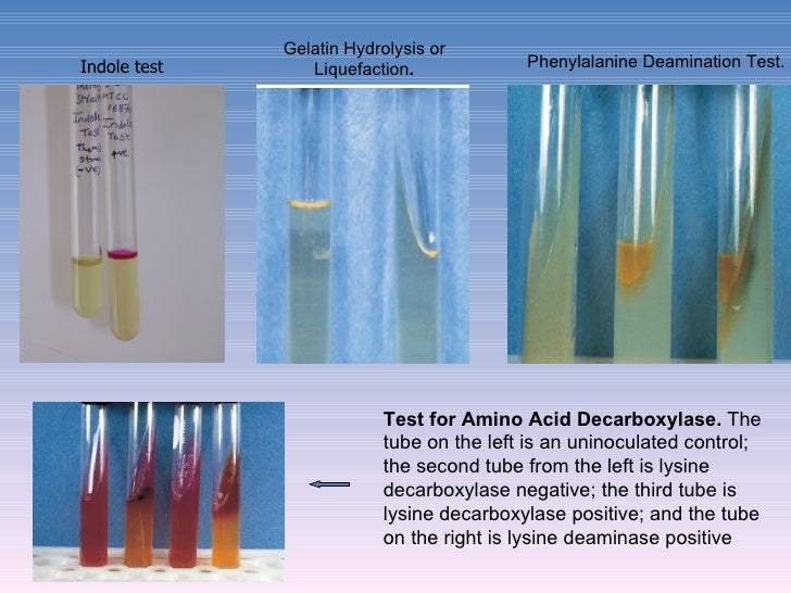 Diagnostic microbiology - Traditional and Modern Approach