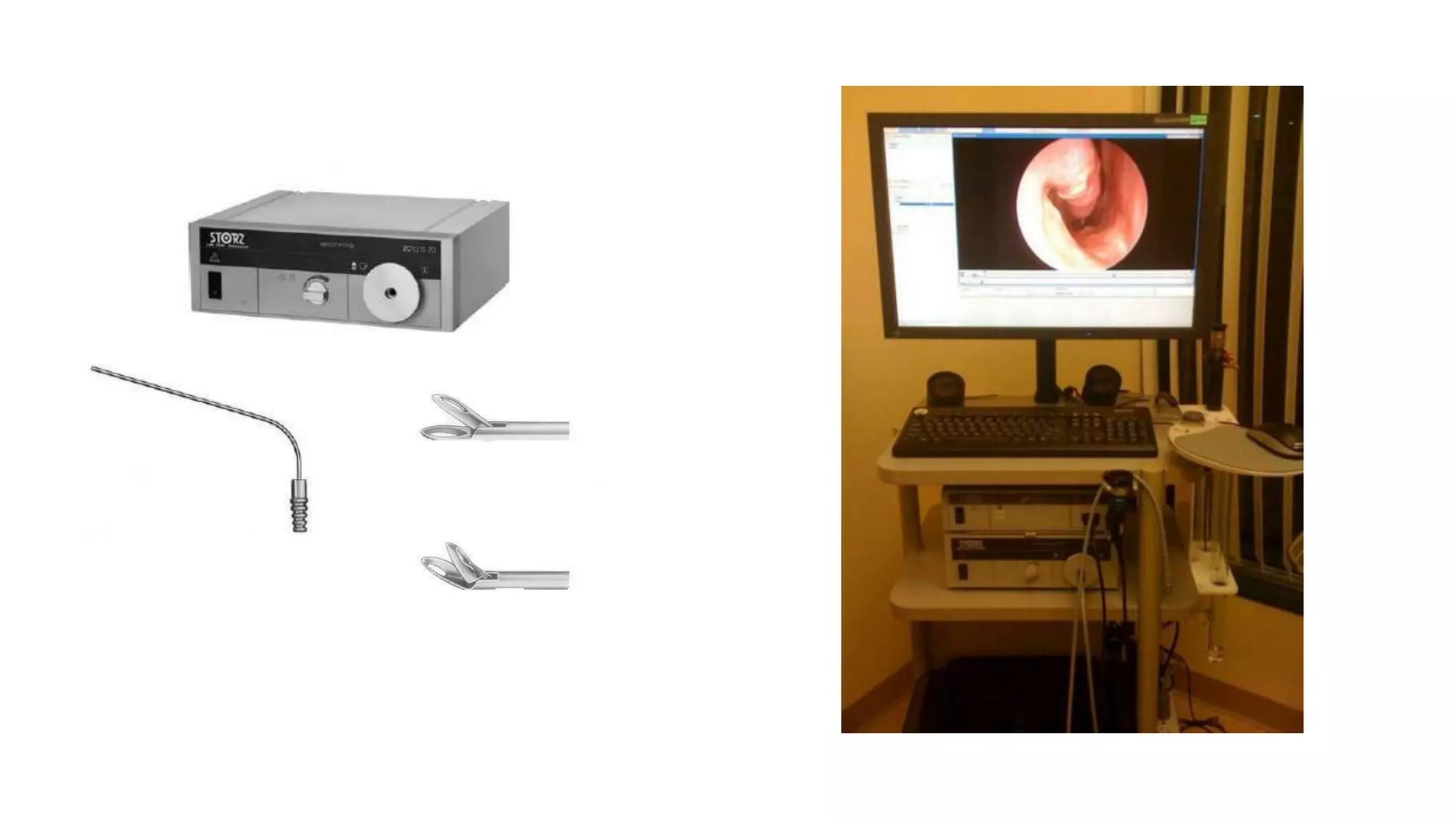 Diagnostic nasal endoscopy | PPTX