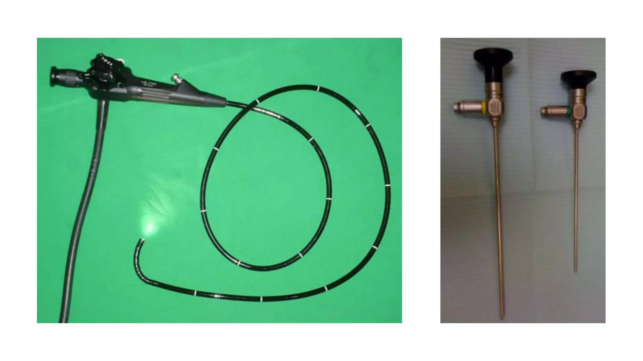 Diagnostic nasal endoscopy | PPTX