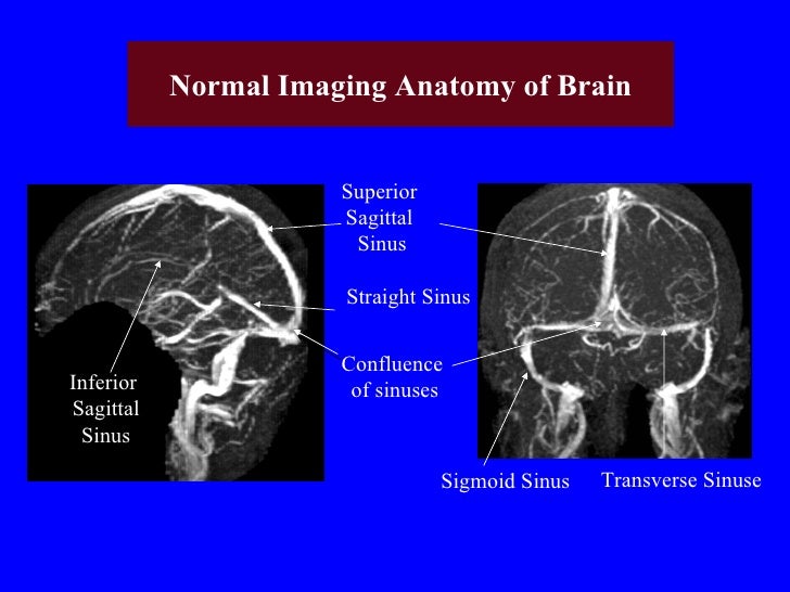 Diagnostic Neuroradiology