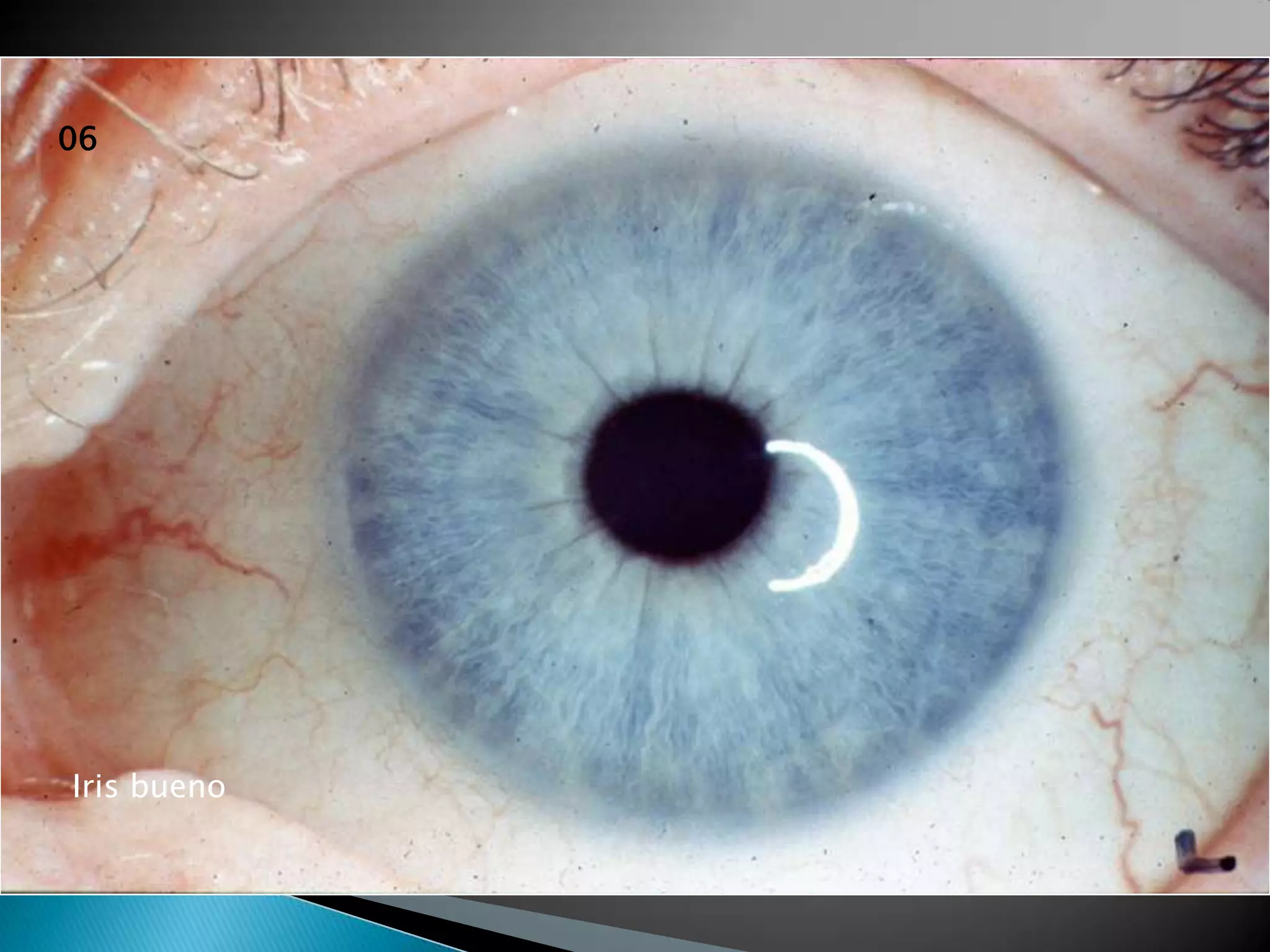 Introduccion a la Iridologia | PPTX