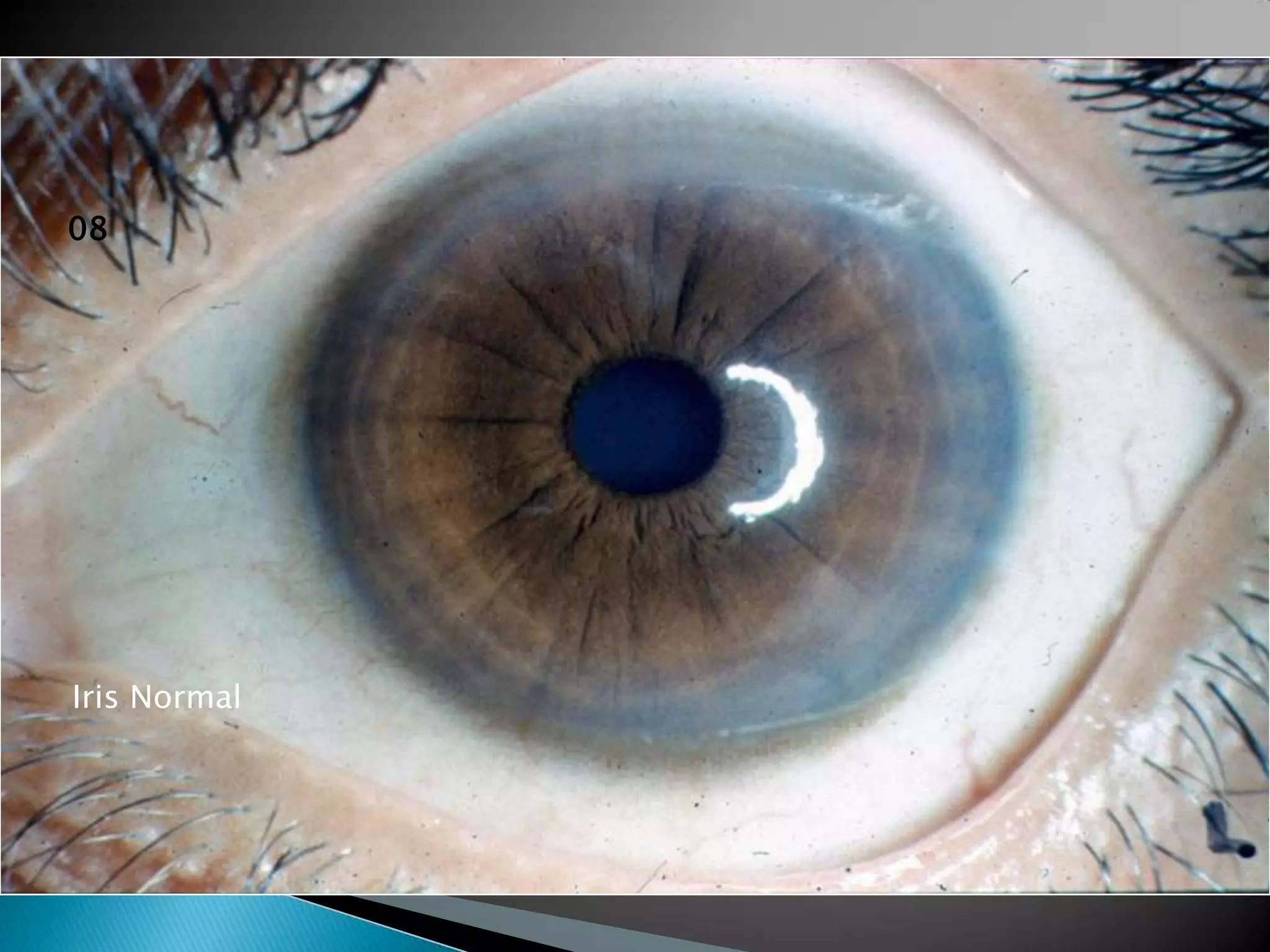 Introduccion a la Iridologia | PPTX