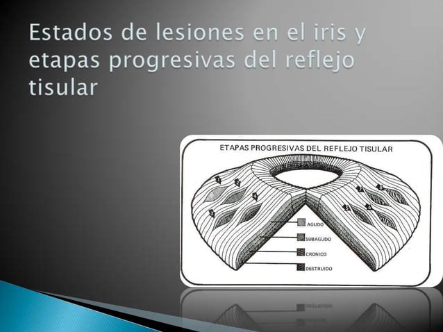 Introduccion a la Iridologia | PPTX