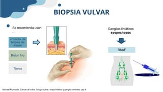 BIOPSIAS, DIAGNOSTICO Y CUADRO CLÍNICO EN CÁNCER DE VULVA | PPTX