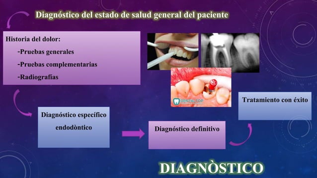 Diagnostico de lesiones pulpares y periapicales | PPT