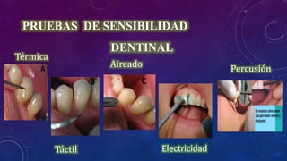 Diagnostico de lesiones pulpares y periapicales | PPT