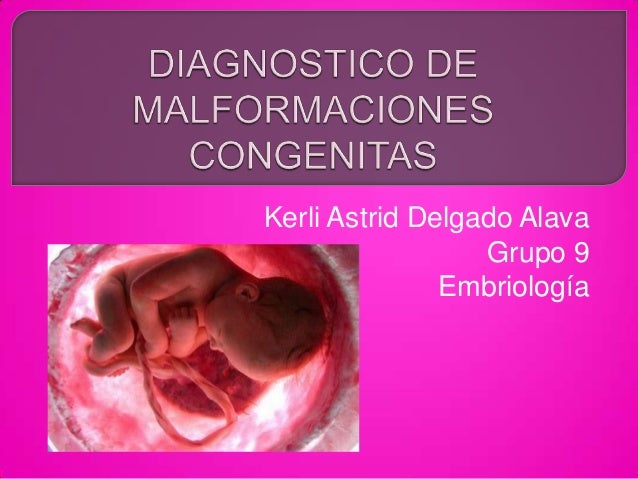 Diagnóstico De Las Malformaciones Congénitas – Estrich Mobil