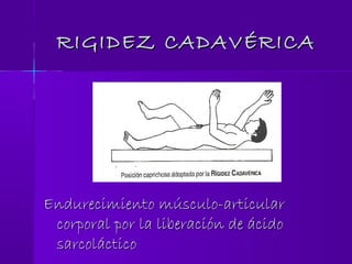 Diagnostico de muerte | PPT