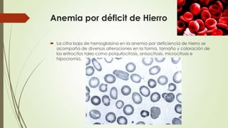 Diagnostico diferencial de las anemias mt | PPTX