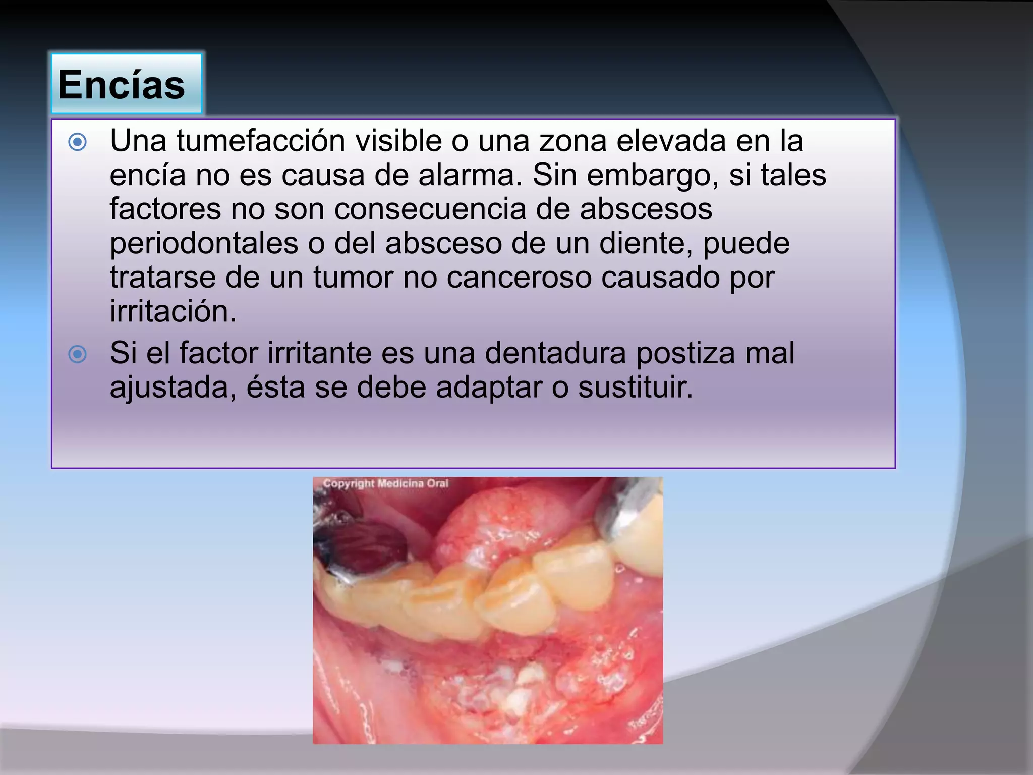 Diagnostico diferencial de las lesiones orales y maxilofaciales | PPTX