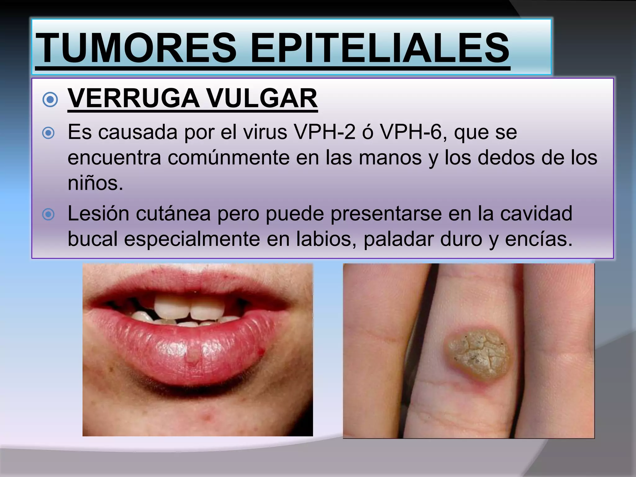 Diagnostico diferencial de las lesiones orales y maxilofaciales | PPTX