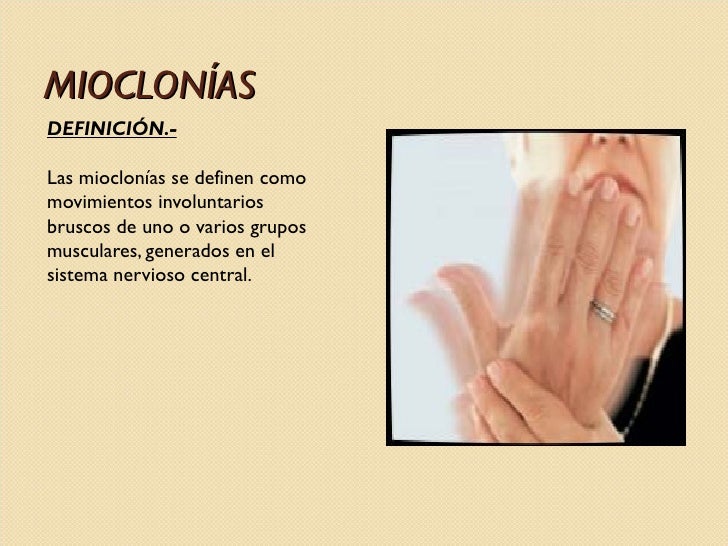 Diagnostico diferencial trastornos del movimiento
