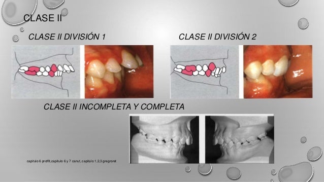 Diagnostico en ortodoncia