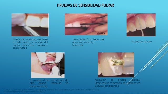 Diagnostico endodoncia
