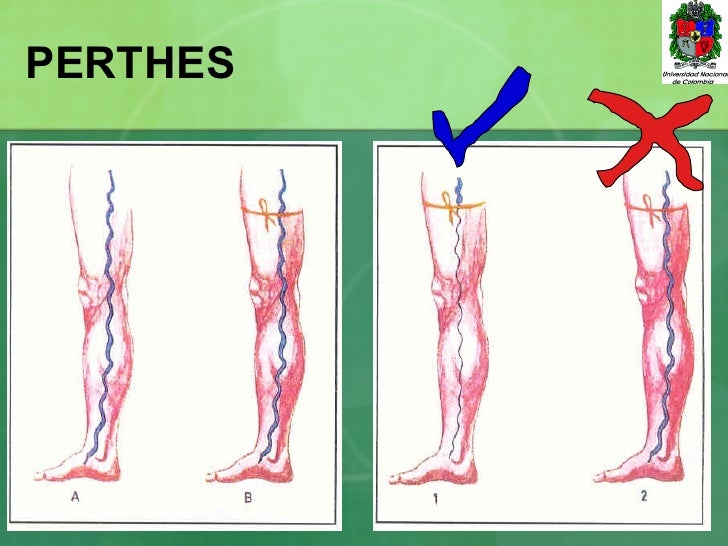 Diagnostico Enfermedad Vascular