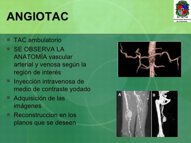 Diagnostico Enfermedad Vascular