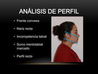 Diagnostico en ortodoncia | PPTX