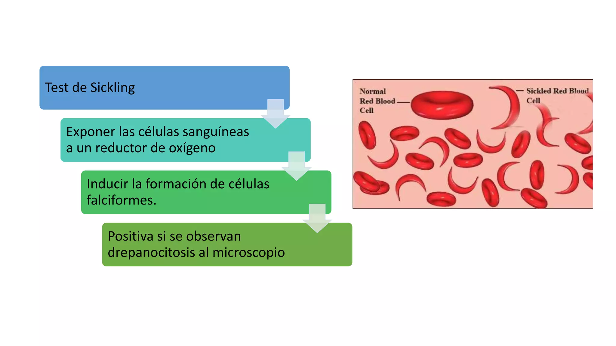 Diagnostico de la enfermedad de la Sicklemia | PPTX