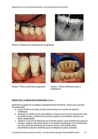 Diagnostico en periodoncia | PDF