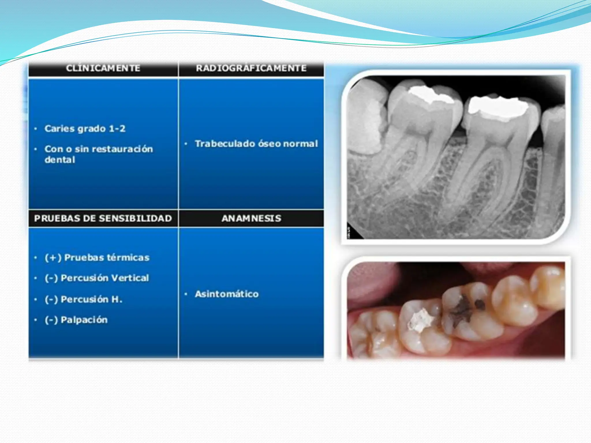 DIAGNOSTICO PULPAR.y periapical endo.pptx