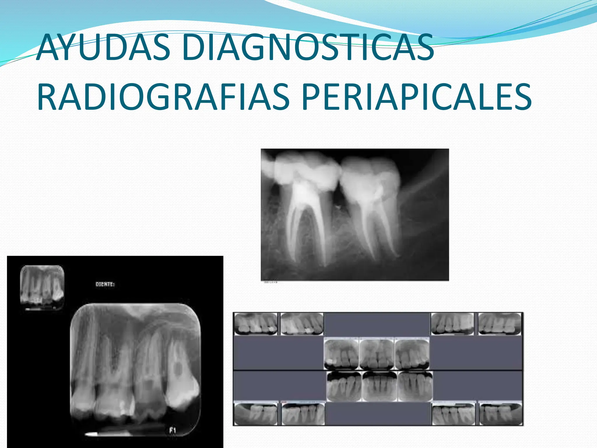 DIAGNOSTICO PULPAR.y periapical endo.pptx