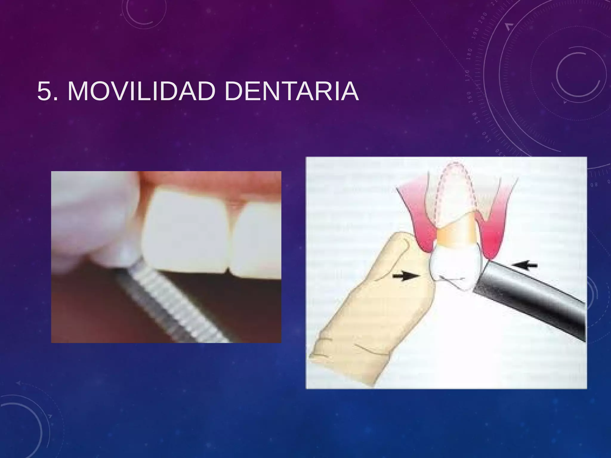 Diagnostico pulpar y patología pulpar | PPT