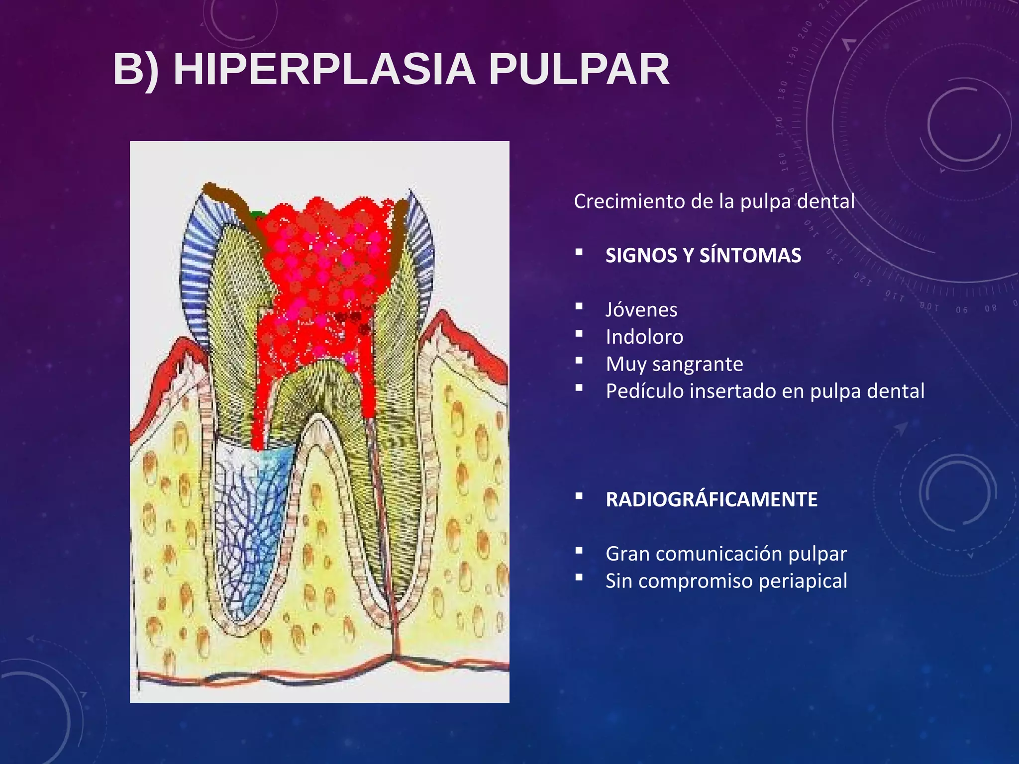Diagnostico pulpar y patología pulpar | PPT