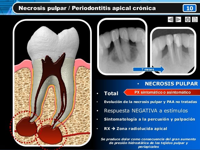 Diagnostico pulpar y_periapical