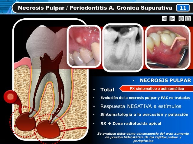 Diagnostico pulpar y_periapical