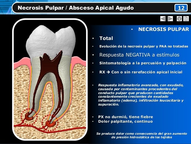 Diagnostico pulpar y_periapical