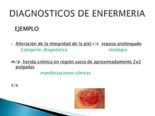 Gallina Estadístico grado diagnostico de enfermeria pes ejemplos ...