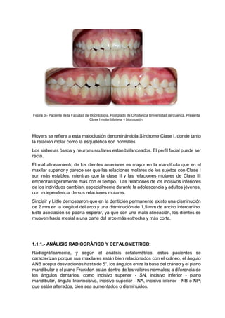 Diagnostico y plan de tratamiento de las maloclusiones | PDF