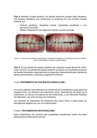 Diagnostico y plan de tratamiento de las maloclusiones | PDF
