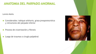 Diagnostico y tratamiento del ectropion | PPTX