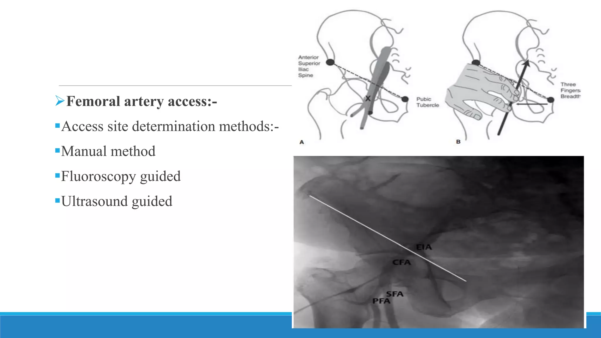 Diagnostic procedure of dsa and management of its | PPTX