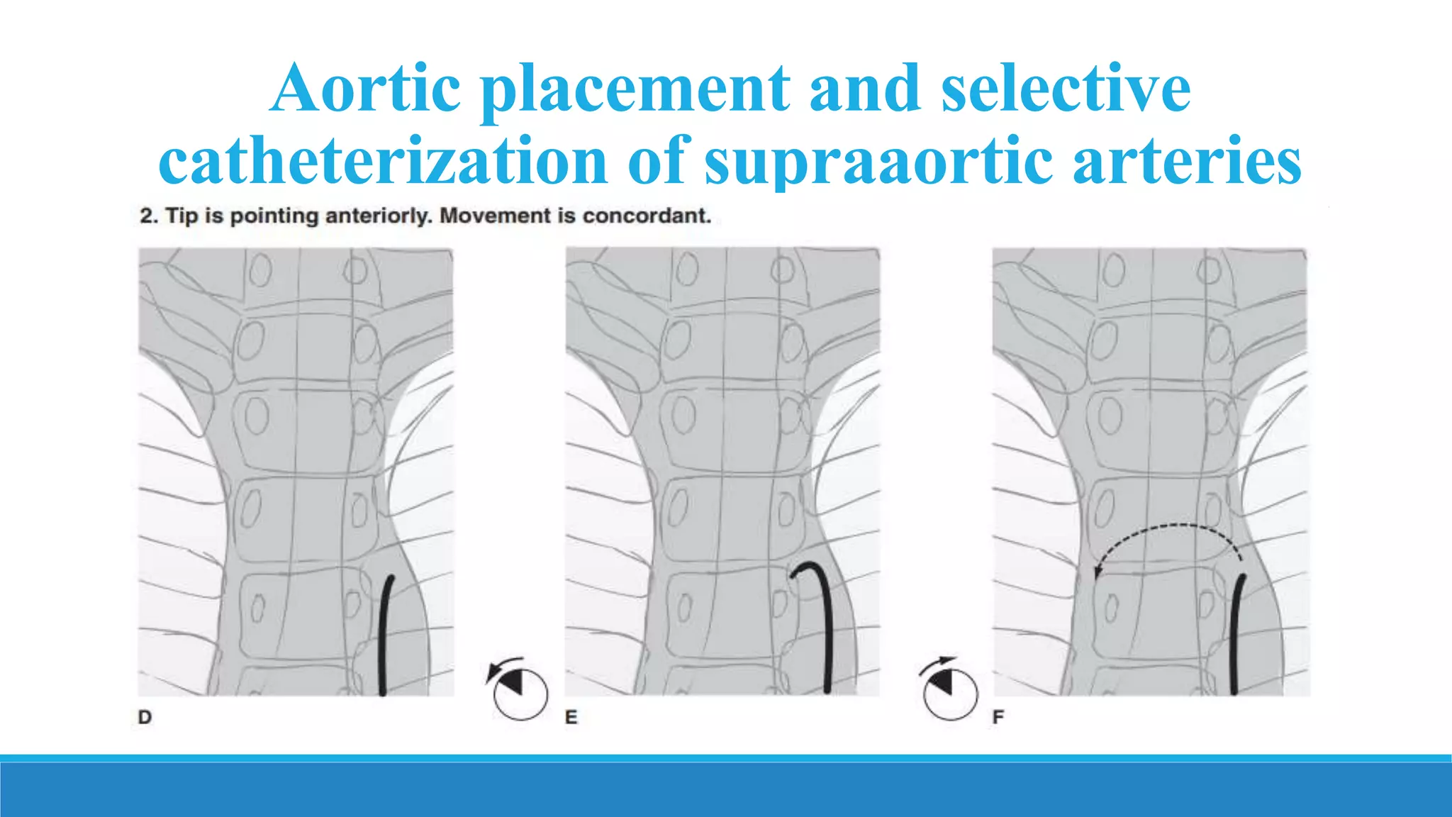 Diagnostic procedure of dsa and management of its | PPTX