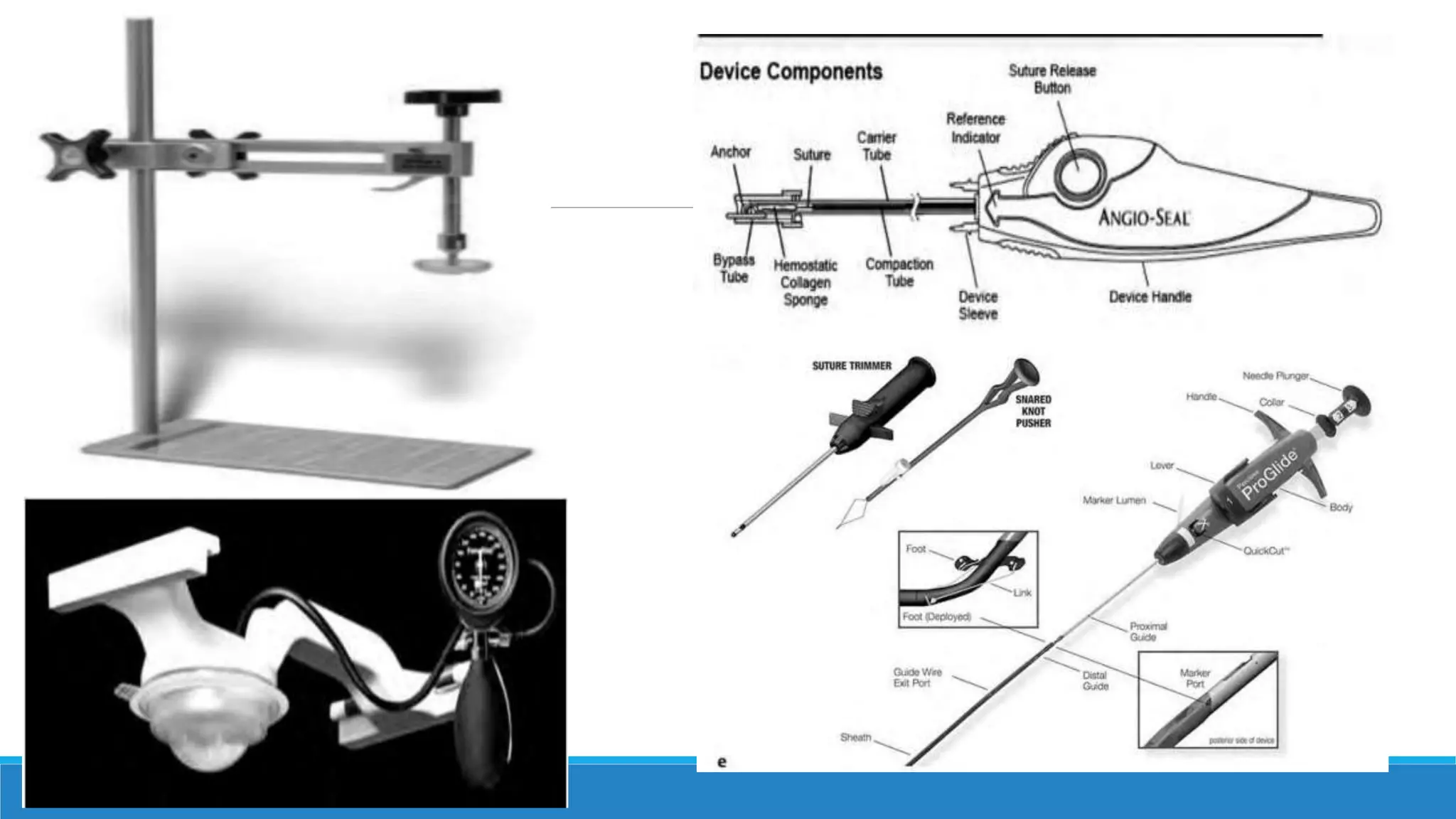 Diagnostic procedure of dsa and management of its | PPTX