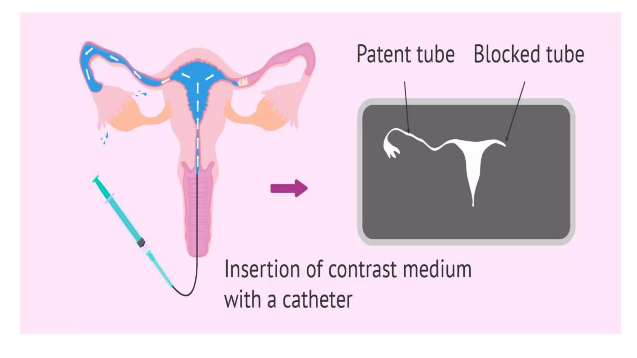 DIAGNOSTIC PROCEDURES.pptx