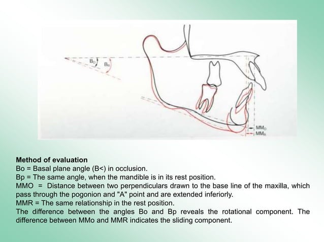 orthodontic Diagnostic procedures 2 | PPT