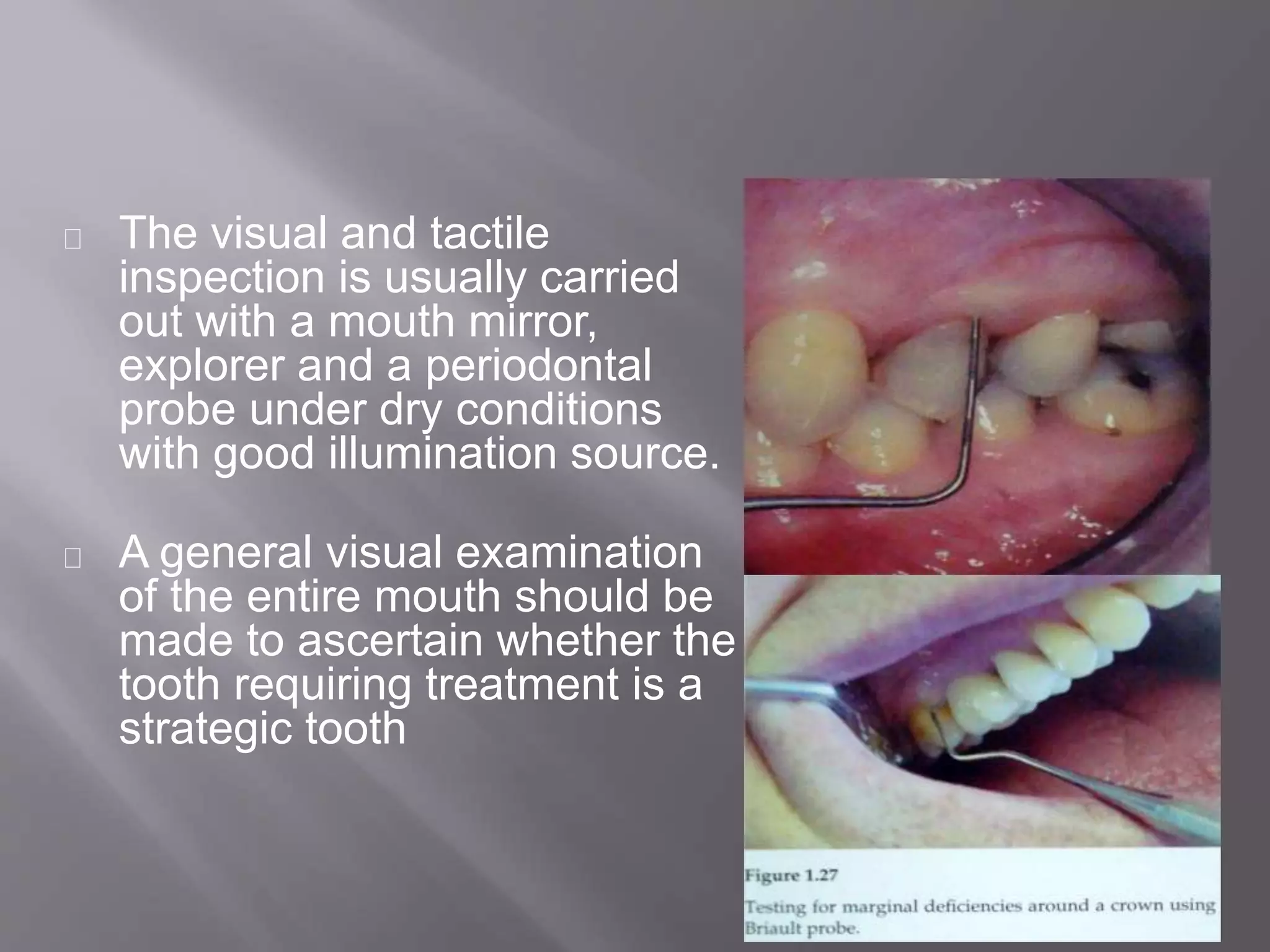 Diagnostic procedures in endodontics | PPTX