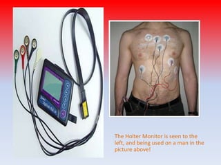 Diagnostic Procedures Of The Cardiovascular System | PPTX
