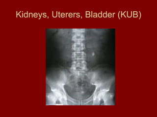 Diagnostic Procedures Of The Urinary System | PPT