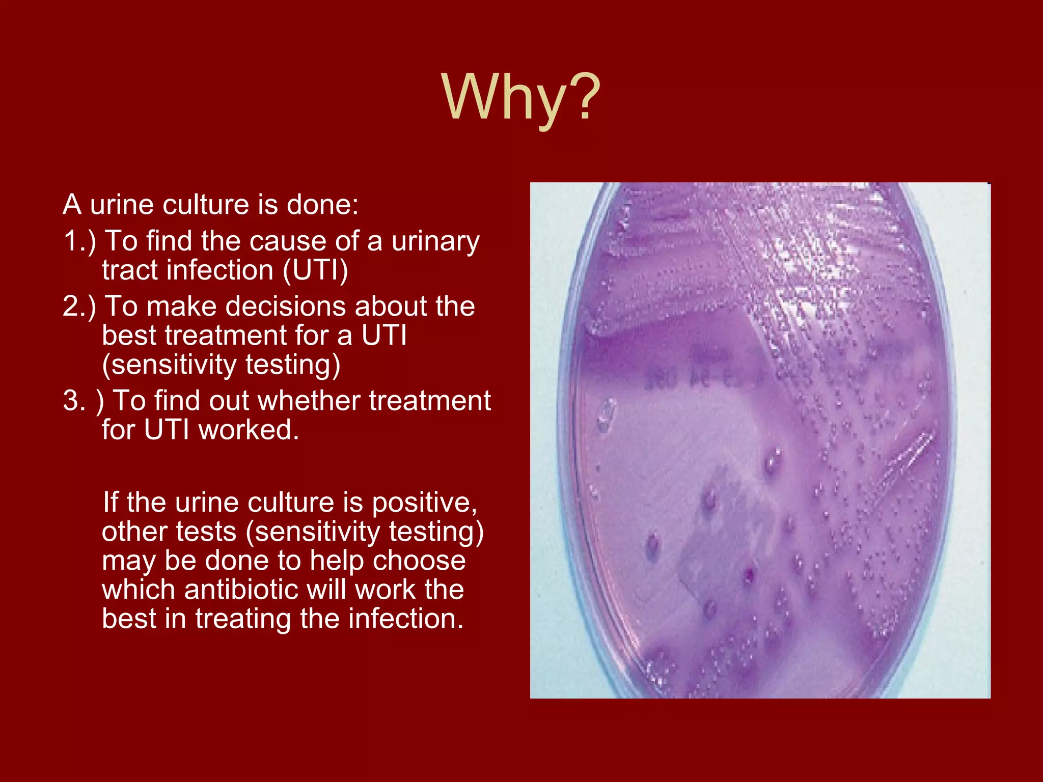 Diagnostic Procedures Of The Urinary System | PPT