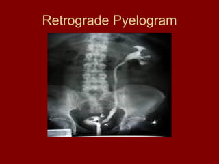 Diagnostic Procedures Of The Urinary System | PPT