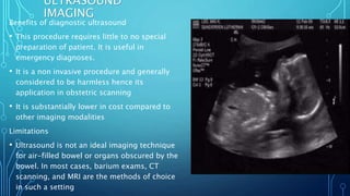 Diagnostic radiography in Ghana | PPTX