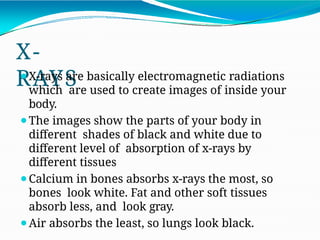 diagnosticradiology-140324071113-phpapp02.pptx